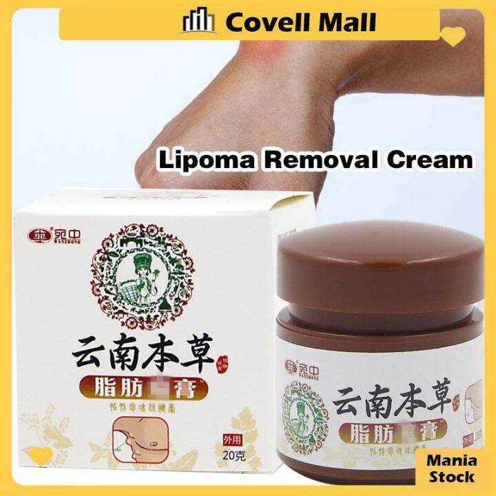 Lipoma Removal Cream Herbal Lipoma Removal Ointment Treat Tumor Skin ...