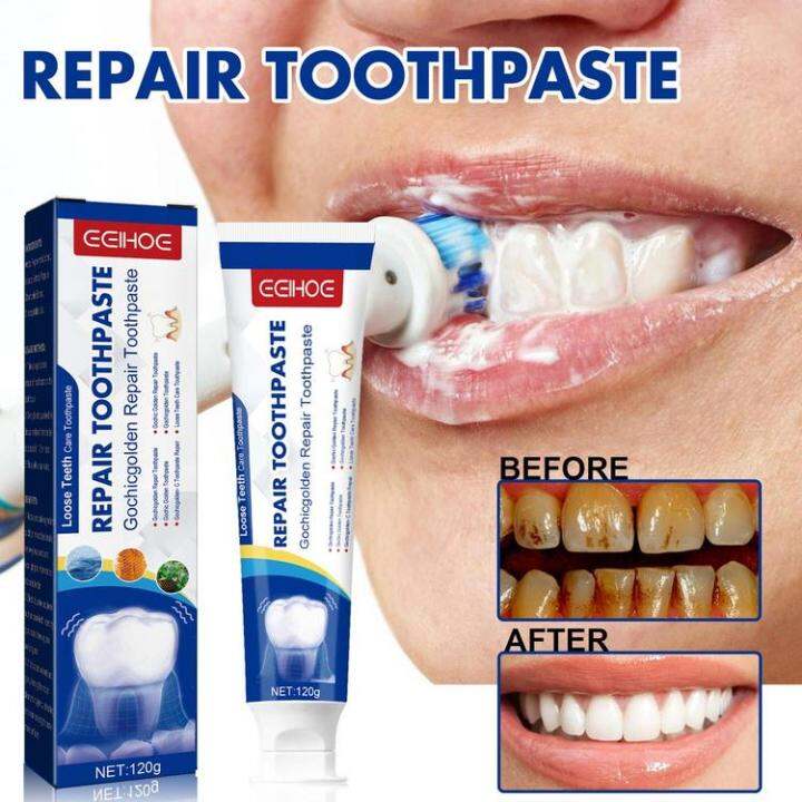 Gum and Enamel Repair Toothpaste Teeth Brightening Cleansing Active Gum ...