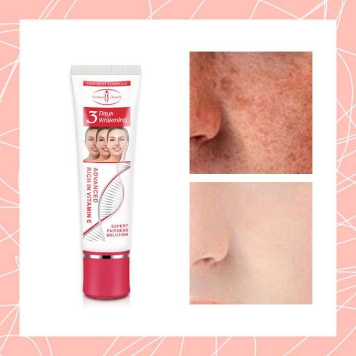 kj-skin whitening cream whitening body cream magic cream original newme ...