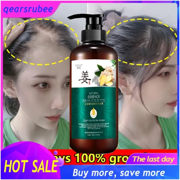 【Hot】Ginger Hair Shampoo Anti Hair Loss Nourish Hair Fast Growth Shampoo Oil Control Anti ...