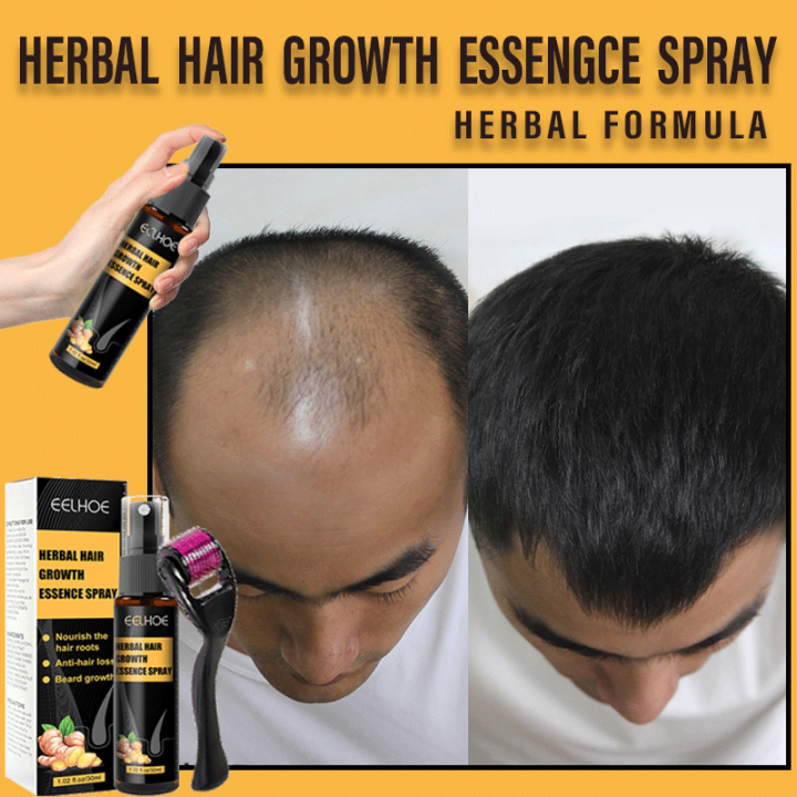 hair grower for men original minoxidil hair grower original hair grower ...