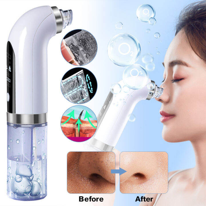 Electric Small Bubble Blackhead Remover USB Rechargeable Water Cycle ...