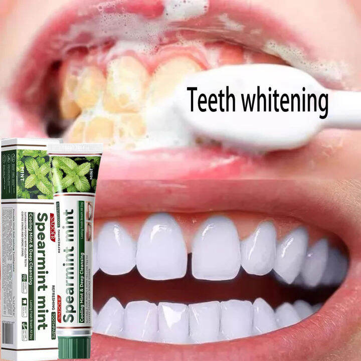 Teeth Cleansing Whitening Toothpaste Removes Stains Teeth Whitening ... Teeth Cleansing Whitening Toothpaste Removes Stains Teeth Whitening ...