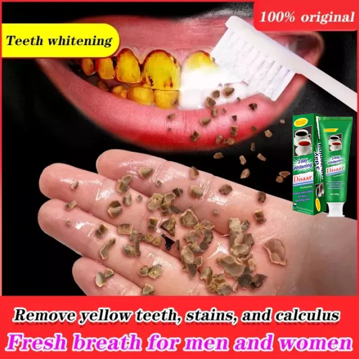 【COD】100g 3 Day Whitening Toothpaste Peppermint Toothpaste Remove ...