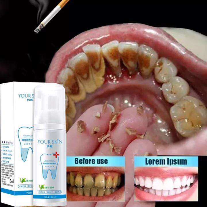 New 2023 YANJIAYI 60ML Teeth Whitening Mousse Toothpaste for Oral ...
