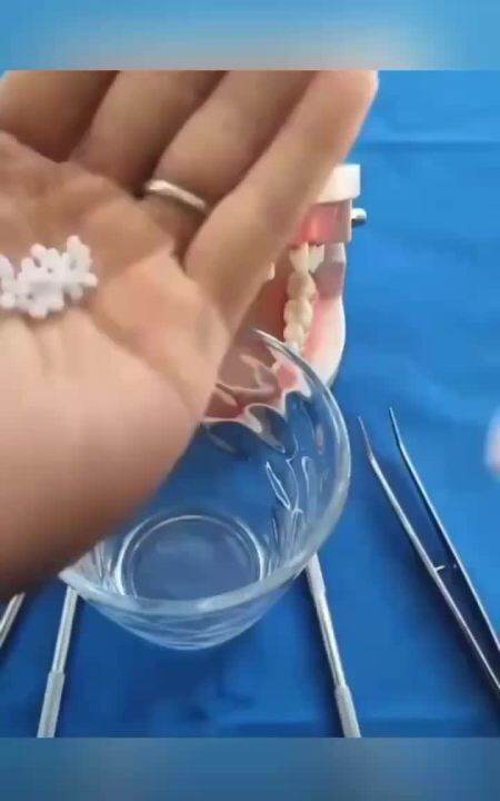 Plastic Resin Temporary Tooth Repair Granules Denture Adhesive Gaps ...