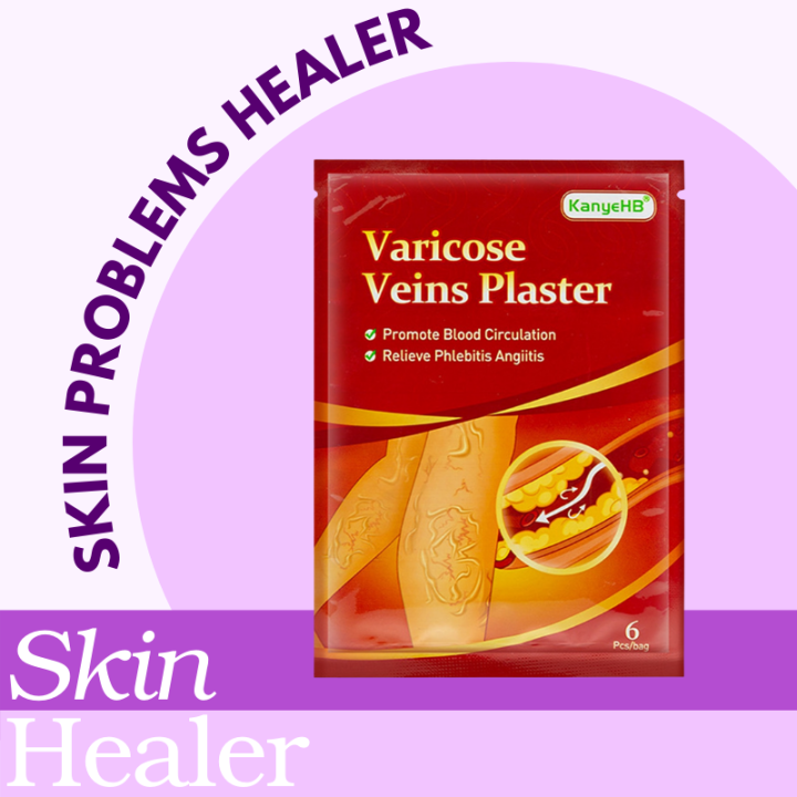 **Goodbye to Varicose Veins!** Easy to Apply | 1 Sachet (6 Bags ...