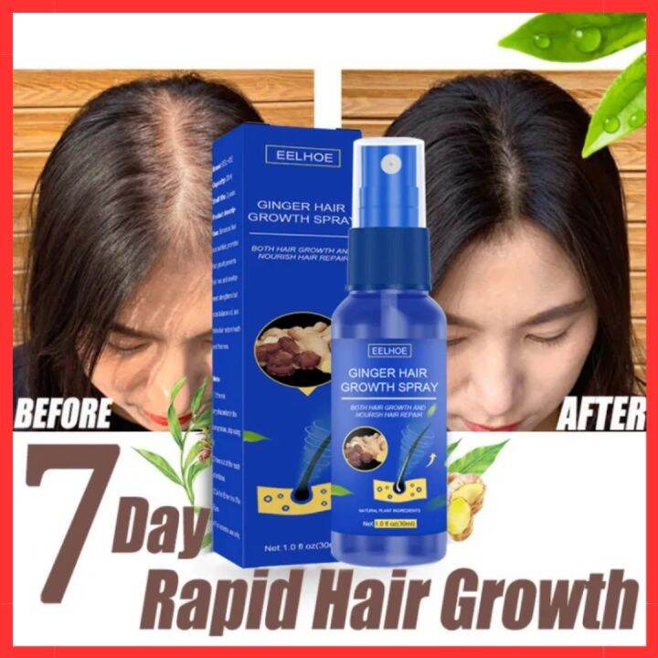 ORIGINAL EELHOE Ginger Hair Growth Spray Hair Regrowth liquid Anti ...
