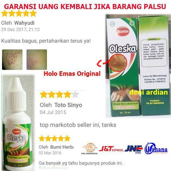 Tasnim Oleska Obat Oles Luka Kulit Gatal ekstrim seperti Panu dan ...