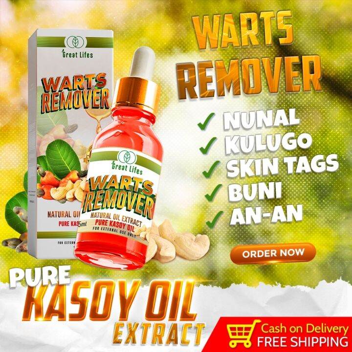 Warts Remover Ointment Kasoy Oil Tanggal Nunal Kulugo Kalyo Kulugo Buni ...