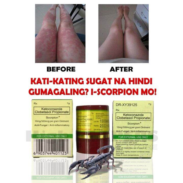Original SCORPION Anti-Itch Ointment Mabisang Gamot sa Kati-Kating ... Original SCORPION Anti-Itch Ointment Mabisang Gamot sa Kati-Kating ...