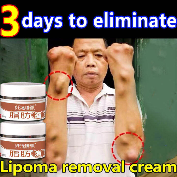 Effective Removal In 3 DaysQIANXUANZHENCAO Lipoma Removal Cream effective-removal-in-3-daysqianxuanzhencao-lipoma-removal-cream