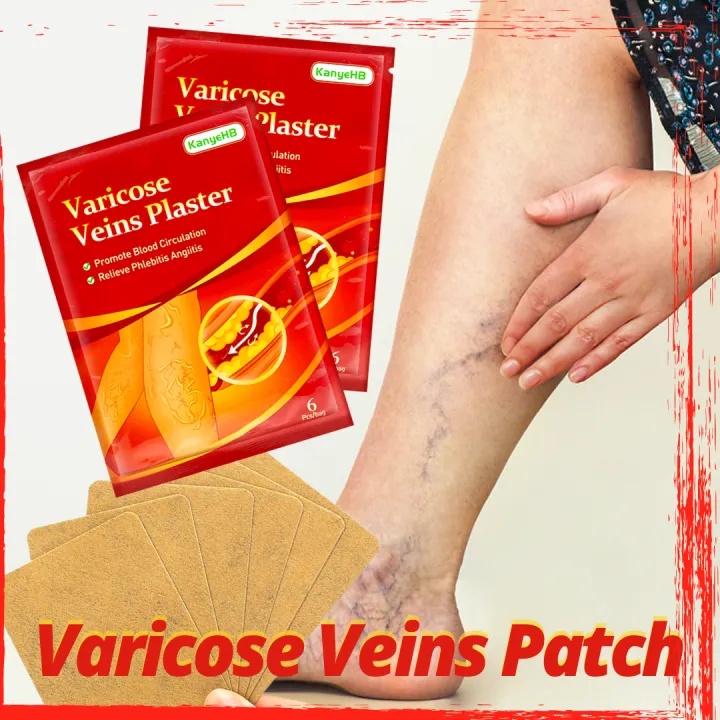 100% ORIGINAL | VARICOSE VEINS PLASTER | Varicose Veins Pain Relief ...