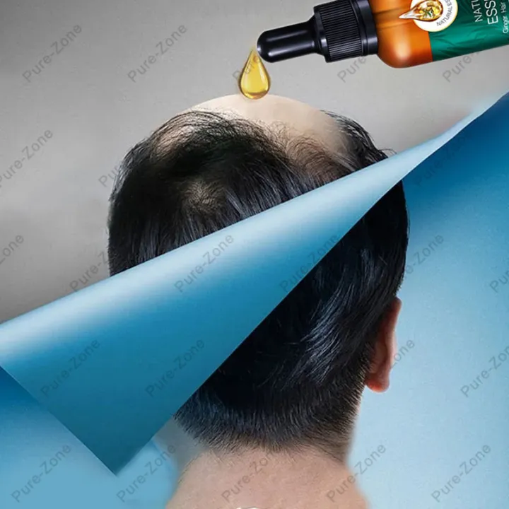 Support COD Castor Oil For Hair Growth Hair Serum Hair Grower Fast Long ...