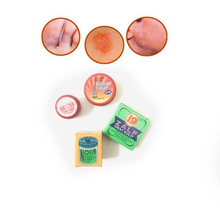 CREAM PANAU , KURAP , KUDIS, GATAL | Lazada