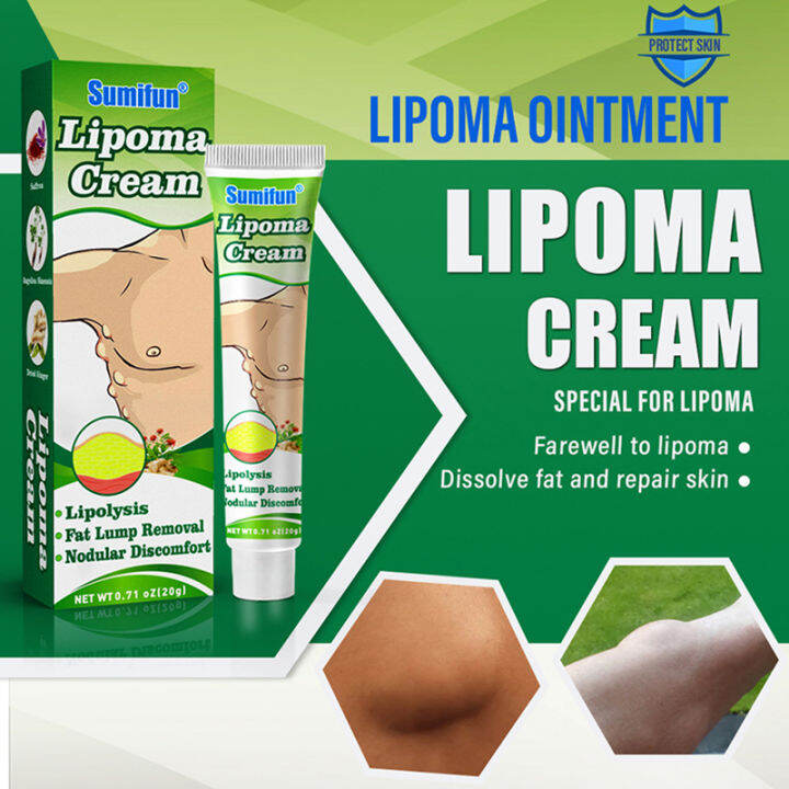 Sumifun Lipoma Cream Lipoma Cream Subcutaneous Fat Lump Lump Flesh ...