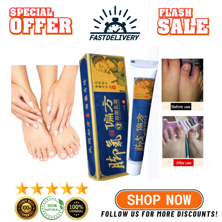 🦶100x Original and Best in the Market Foot Care Treatment 15g| READY ...