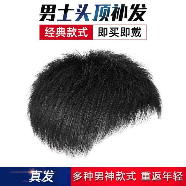 Mga tablet ng pagpapalit ng buhok ng lalaki, wigs, tuktok ng ulo ...