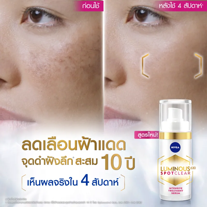 NIVEA Luminous 630 Spotclear Intensive Treatment นีเวีย ลูมินัส 630 สปอ ...