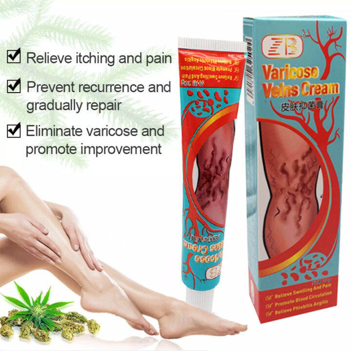 ZB Varicose Vein Removal Cream Treatment Spider Vein Pain Varicosity ...