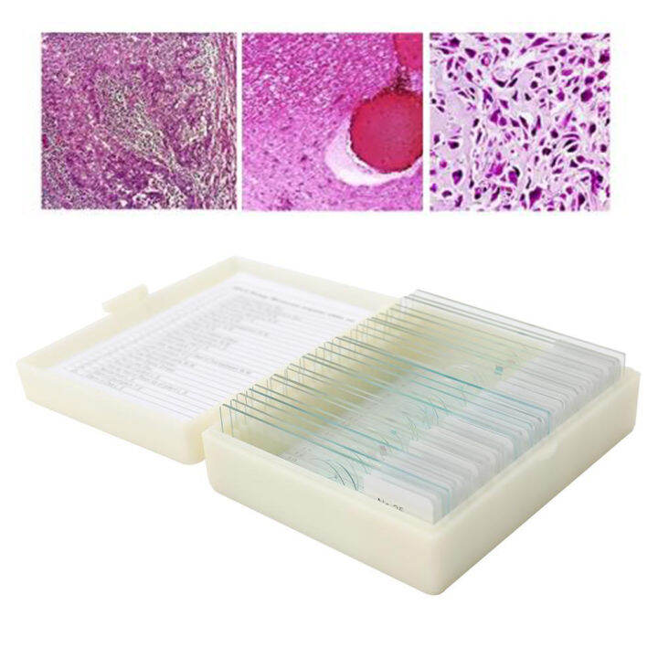 30PCS Medical Pathological Sections for Educational Prepared Tissue ...