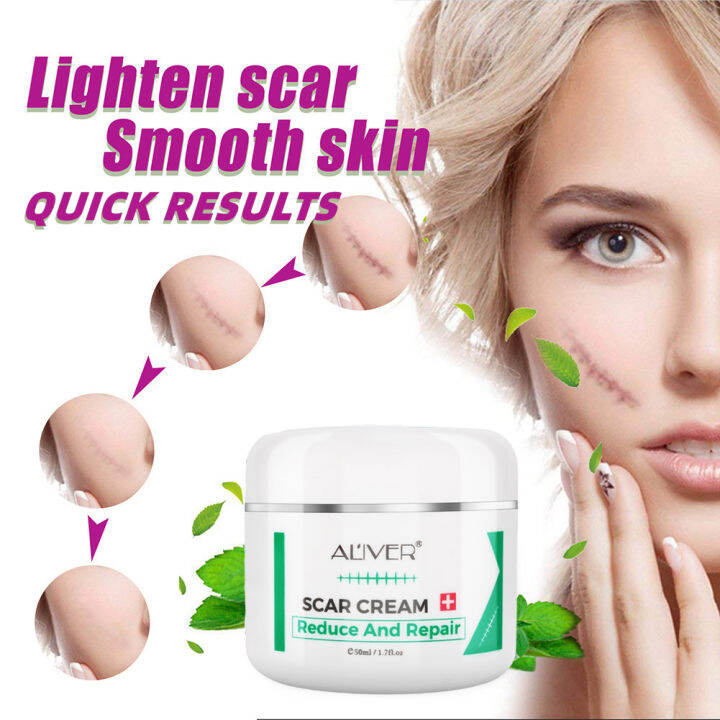 ALIVER Scar Repair Cream Remove Acne Scar remover Stretch Mark Scald ... ALIVER Scar Repair Cream Remove Acne Scar remover Stretch Mark Scald ...
