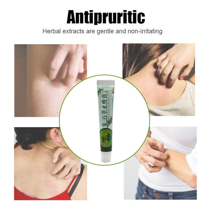 ZB 20g Eczema Treatment Cream gamot sa kati kati sa balat buni ...