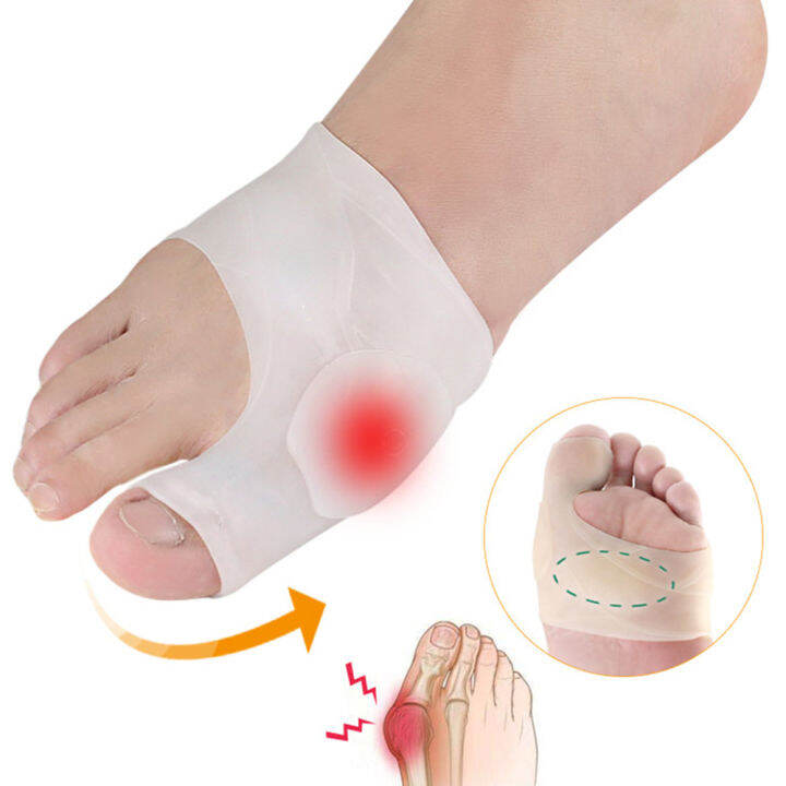 EELHOE Big toe overlap toe splitter great toe valgus splitter bigfoot ...