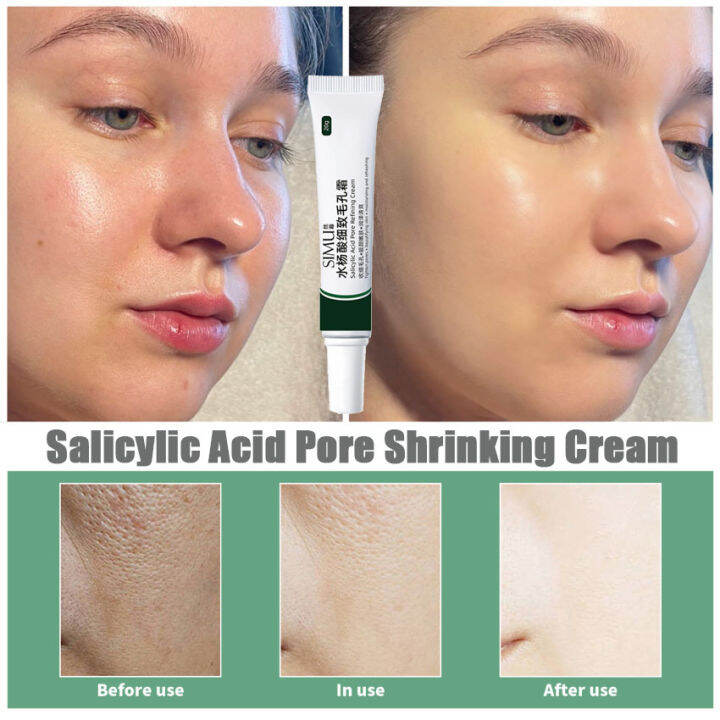 Salicylic Acid Pore Shrinking Cream Face Tightening Repairing Large Pores Removal Blackehead