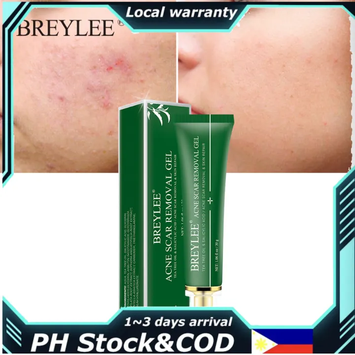 BREYLEE Acne Pimple Scar Removal Stretch Marks Pigmentation Acne ...