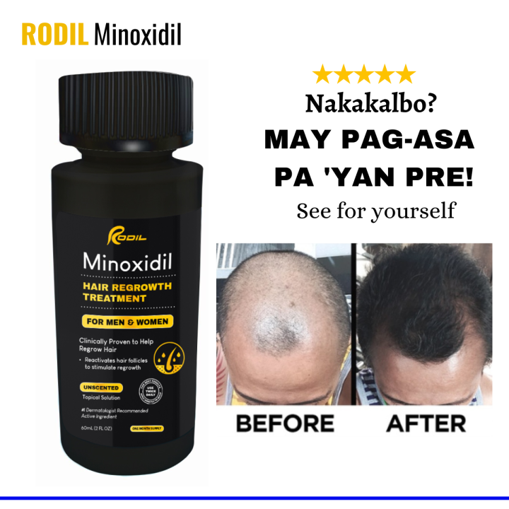Rodil Minoxidil Strands 5% Topical Solution Hair Grower Beard Grower 60ml | Lazada PH