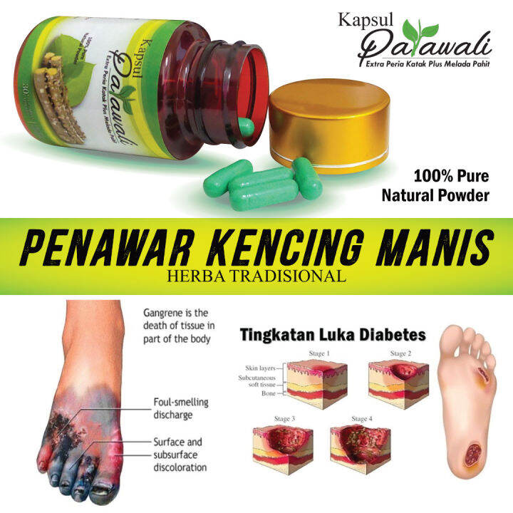 Pil Patawali Tinospora Crispa 100 % Natural Herb Peria Katak | Lazada