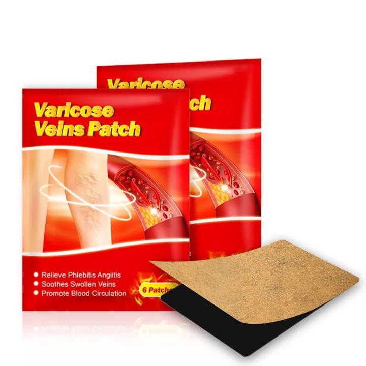 6Pcs Varicose Veins Stickers Promoting Blood Circulation Spider ...
