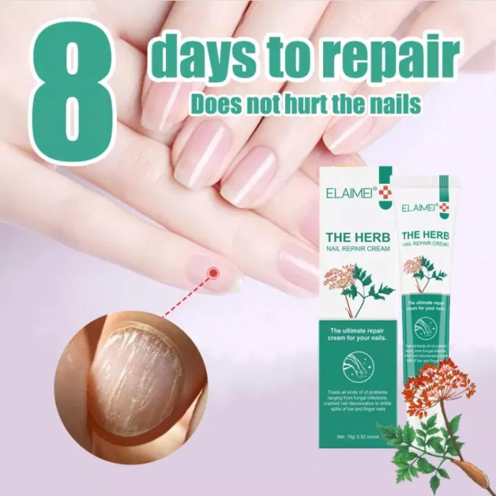 nail repair cream nail repair essence nail fungus treatment 20g ...