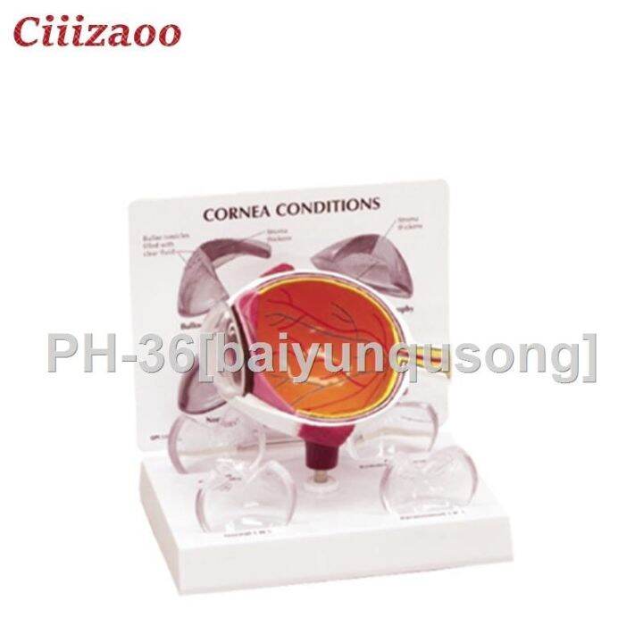 Medical Education human pvc eye cornea conditions Eye Model Anatomy ...
