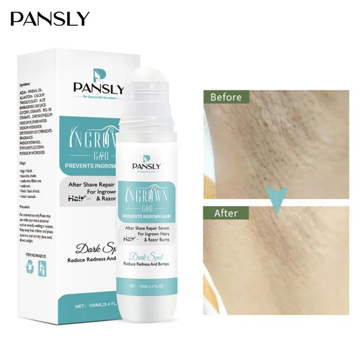 PANSLY Permanent hair removal spray inhibits hair growth fast and ...