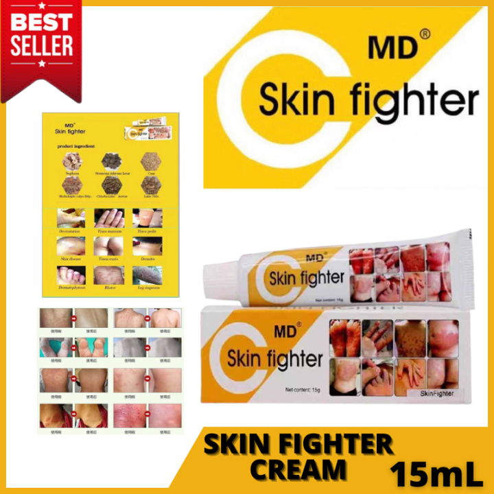 100% Original MD Skin Fighter Cream for Skin Allergies or Fungis 15gm | Lazada PH
