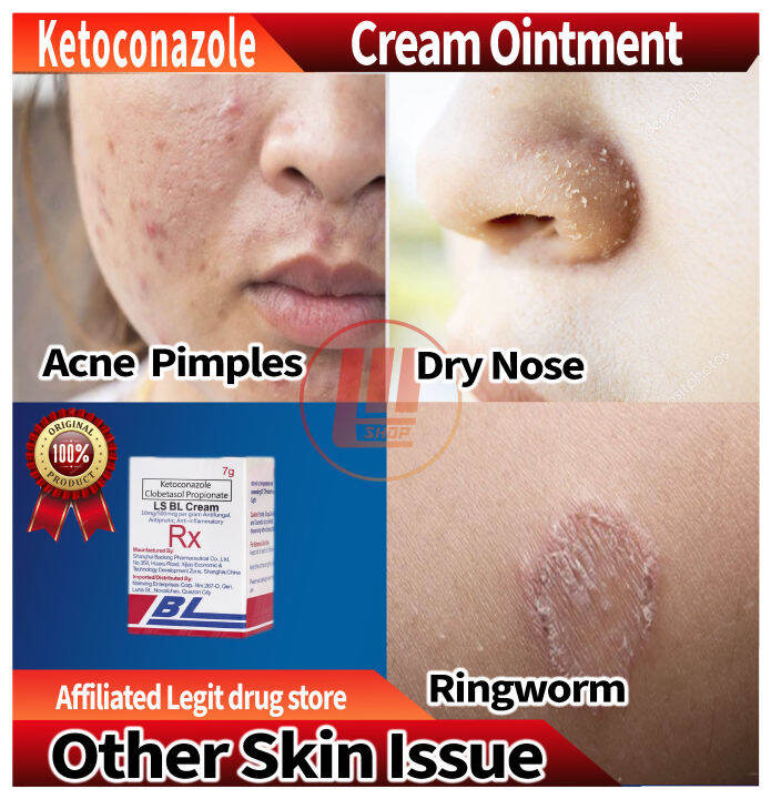 Cream For An-an Buni Alipunga hadhad Skin Dry issues (Authentic) 7g ...