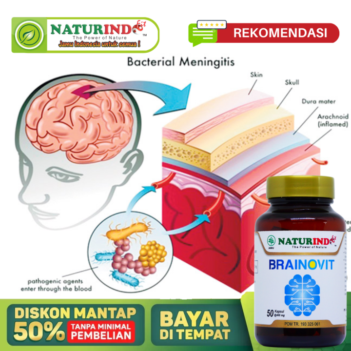 Obat Herbal Radang Selaput Otak Paling Ampuh, Meningitis, Radang Otak ...
