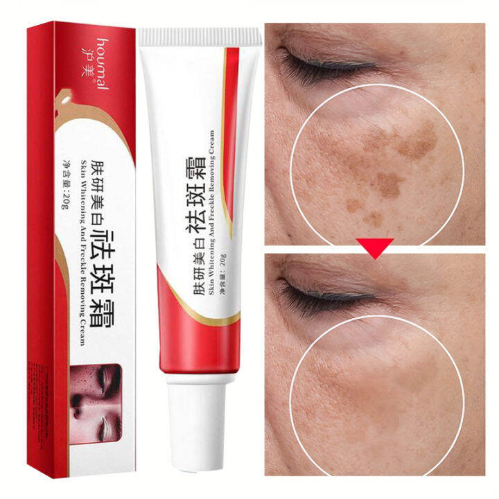Whitening & Freckle Remover Cream remove dark spots on face melasma and pekas remover original ...