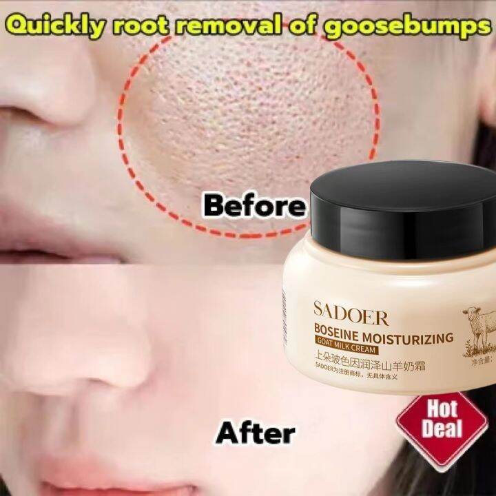 SADOER Skin Barrier Repair Boseine Moisturizer Cream 120g | Pelembab ...