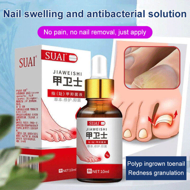 ganze011 Nail Swelling Antibacterial Solution | Lazada PH