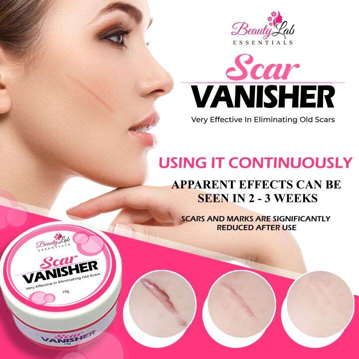 BEAUTY LAB ESSENTIALS SCAR VANISHER 10g for STRETCH MARKS Scar remover ...