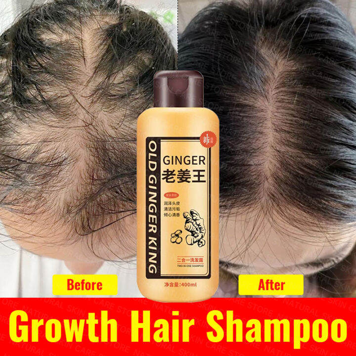 Ginger Hair shampoo Anti Hair Loss Nourish Hair Fast Growth Shampoo Oil Control Anti-Dandruff ...