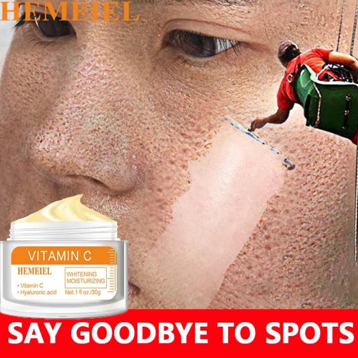 HEMEIEL Retinol Cream Melasma Anti Aging/Freckles Remover Cream/Dark ...