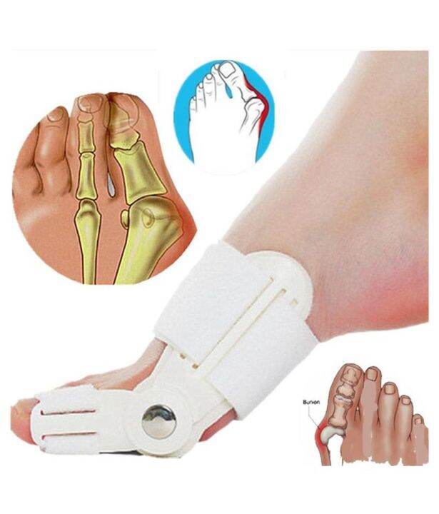 (1 PC) Toe Separator Bunion Orthotics Pedicure Hallux Valgus Corrector Pro Orthopedic Adjuster ...