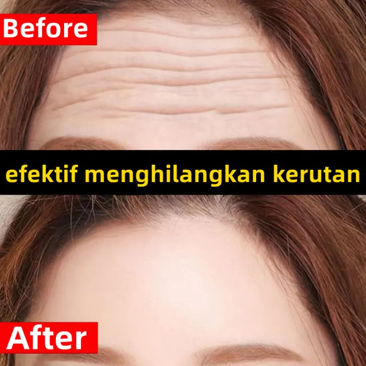 Krim wajah anti kerut /meningkatkan dengan cepat /efektif anti kerut ...