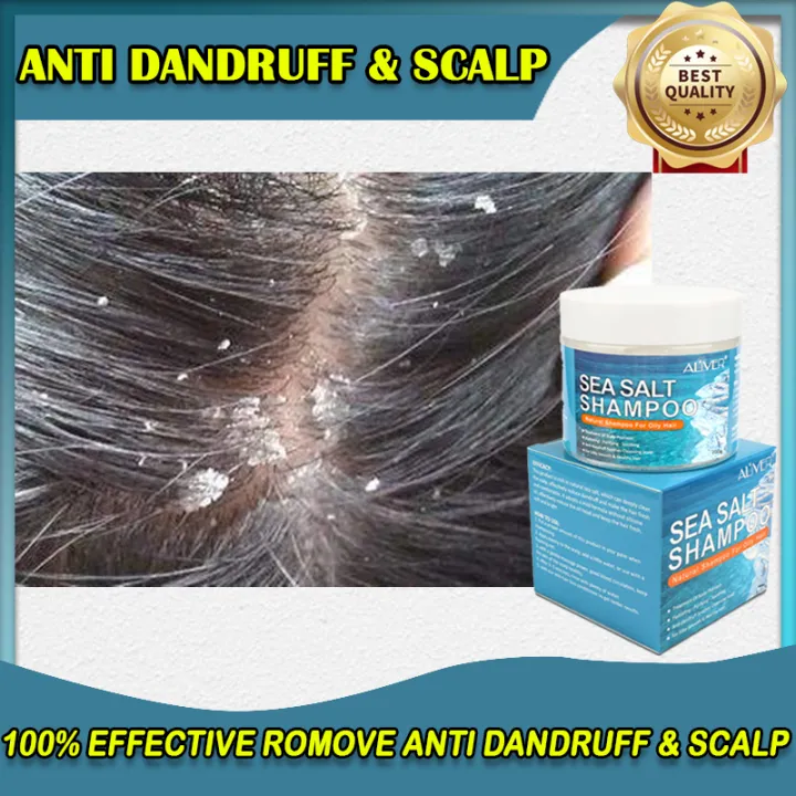 【MessiShop】[Best seller first] Dandruff Remover Shampoo anti Dandruff ...