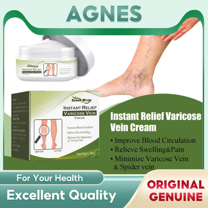 South Moon Varicose Vein Repair Cream Tongmai Effective Relieves Leg ...