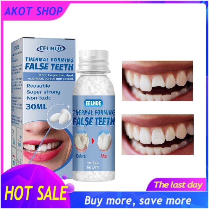 Hot 】[READY STOCK] Plastic Teeth Glue Makeup Dentures Modified ...